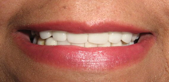 Smile Gallery Khorsand Dental Group | Before & After