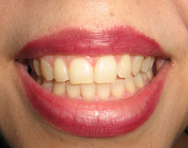 Smile Gallery Khorsand Dental Group | Before & After