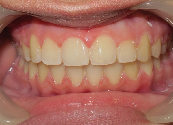 Smile Gallery Khorsand Dental Group | Before & After