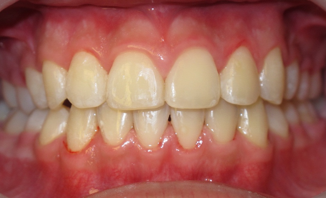 Smile Gallery Khorsand Dental Group | Before & After