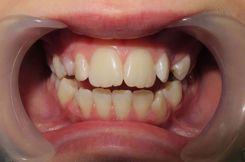 Smile Gallery Khorsand Dental Group | Before & After